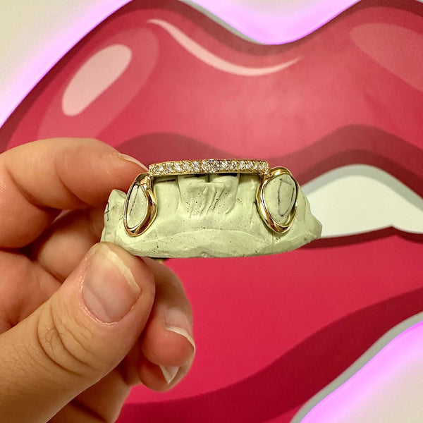 Grillz Australia, Gold Grillz, Sterling Silver Grillz, Iced Out Grillz ...