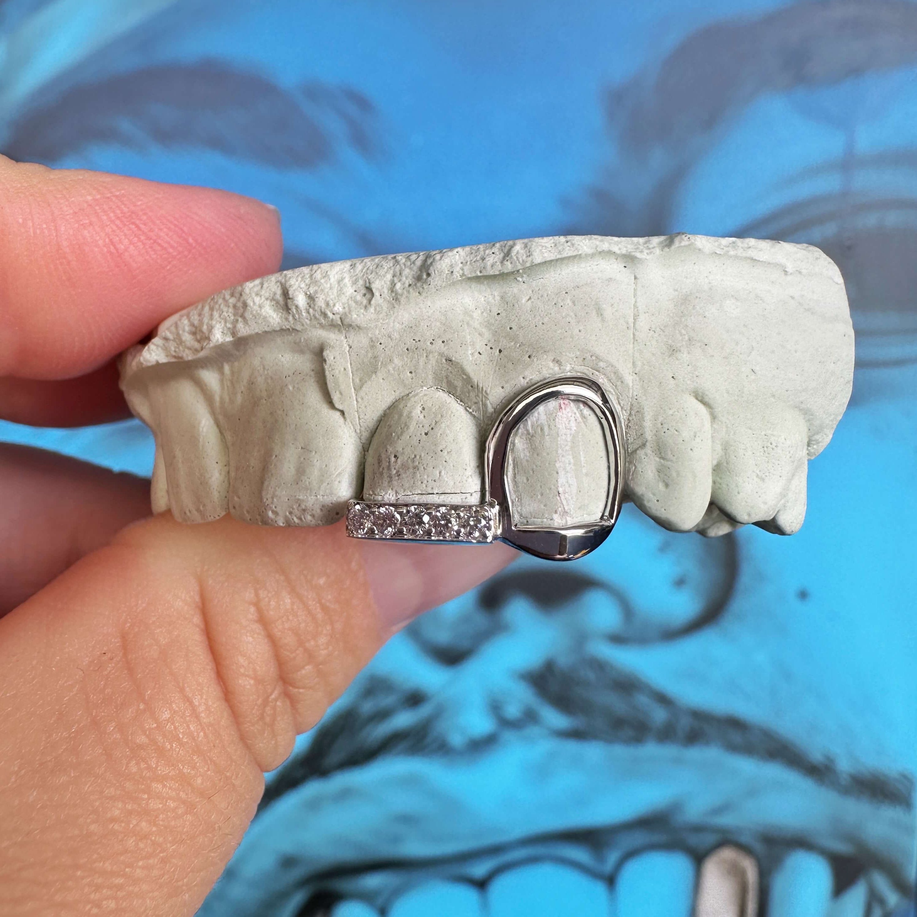 Grillz Australia, Gold Grillz, Sterling Silver Grillz, Iced Out Grillz ...