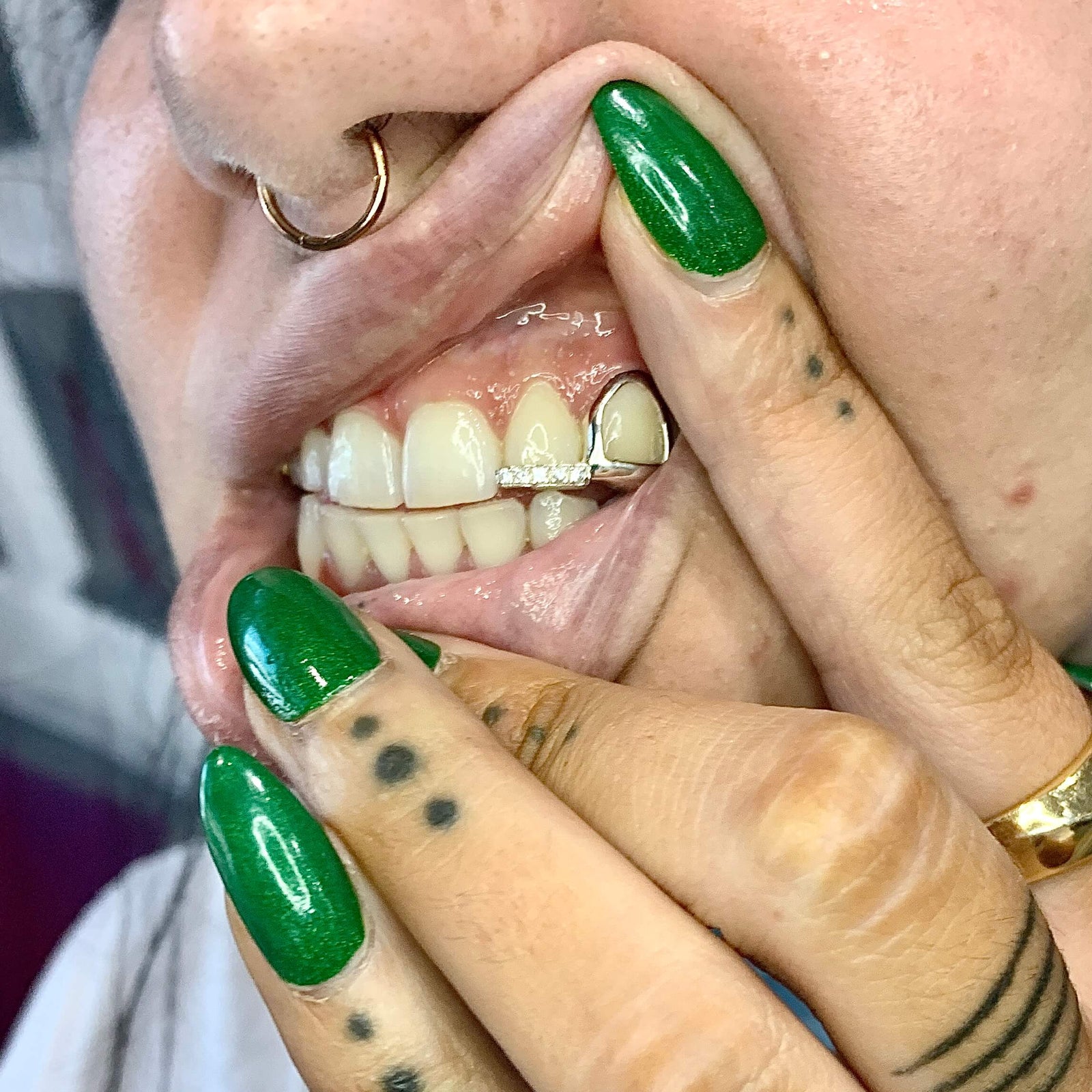 Canine & Iced Front Bar Grillz - Grillz Australia · Mouth House